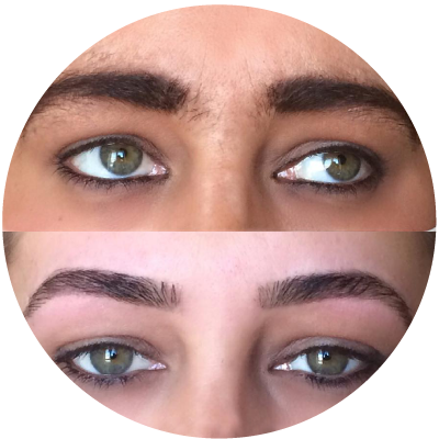 Uneven Eyebrows: Causes, Treatment & Tips | HD Brows