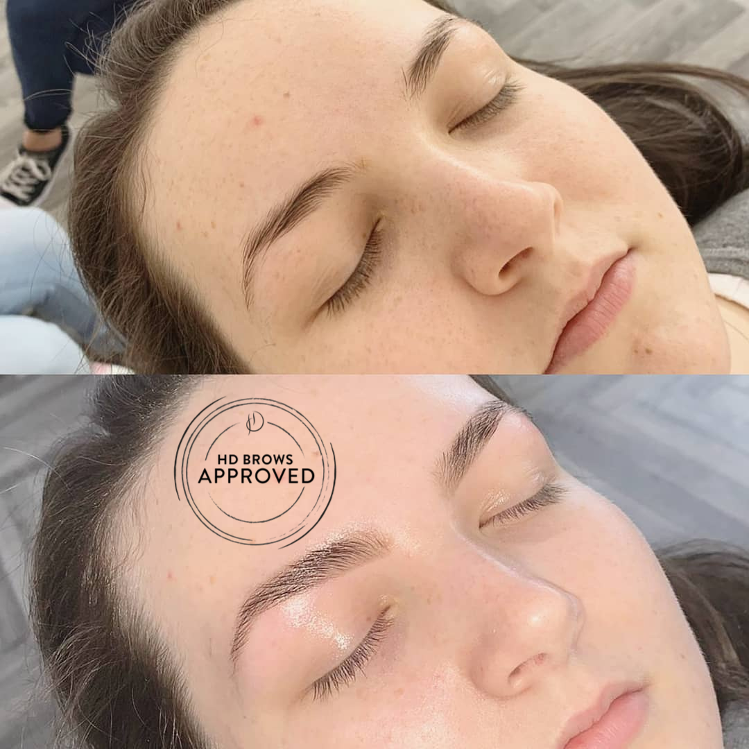 Before & Afters | HD Brows®