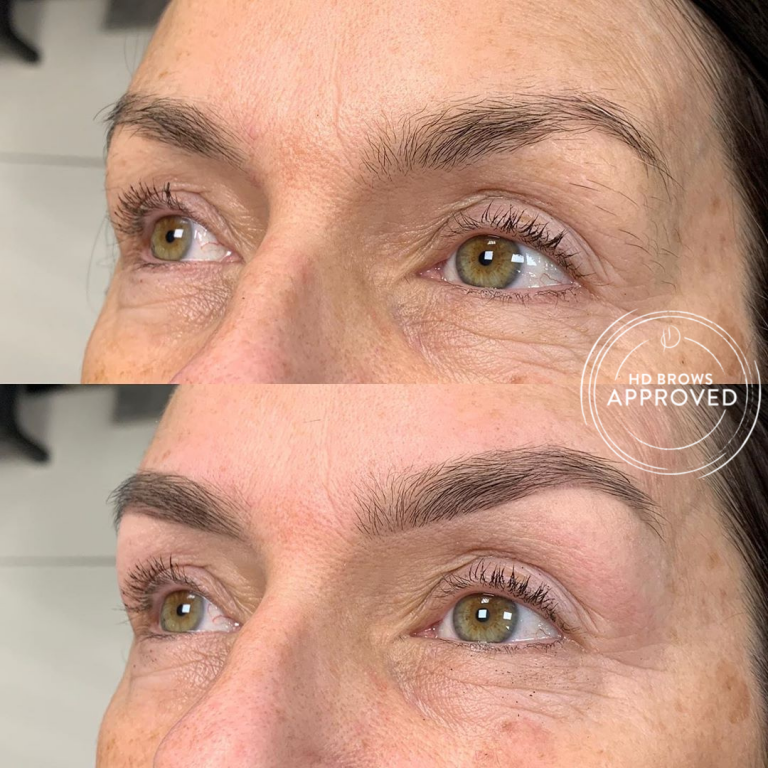 Before & Afters | HD Brows®
